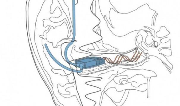 EarHero: Audífonos que evitan atropellamientos