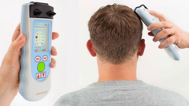 Infrascanner para la detección de hematomas cerebrales