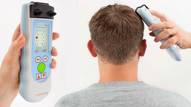 Infrascanner para la detección de hematomas cerebrales