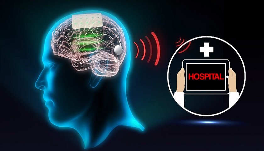 Estos sensores de grafeno monitorean la actividad cerebral